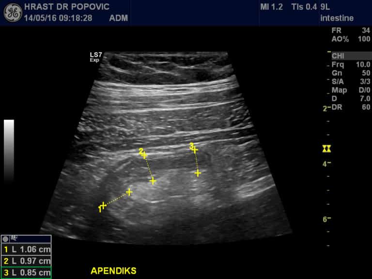 Ultrazvuk abdomena i male karlice - ORDINACIJA HRAST DR POPOVIĆ