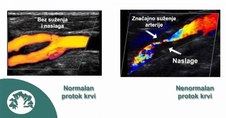 Kolor dopler: najsavremenija tehnologija za preciznu medicinsku ...